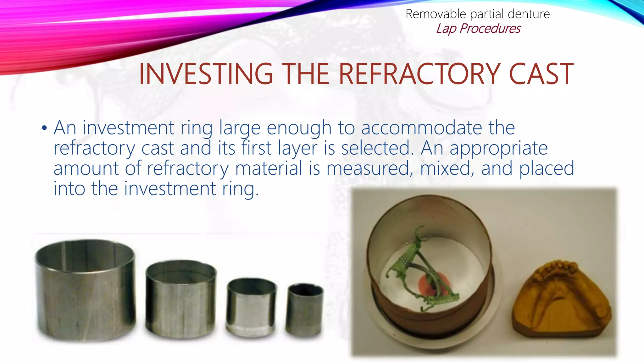 Lab steps of partial denture framework construction | PPTX