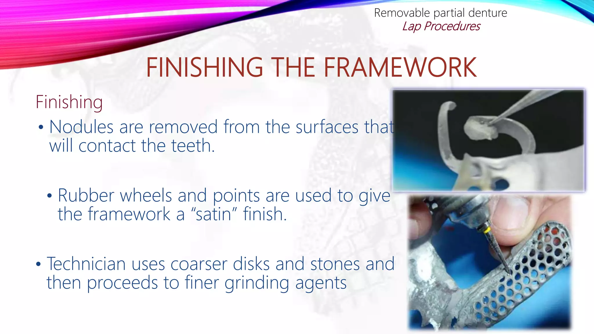 Lab steps of partial denture framework construction | PPTX