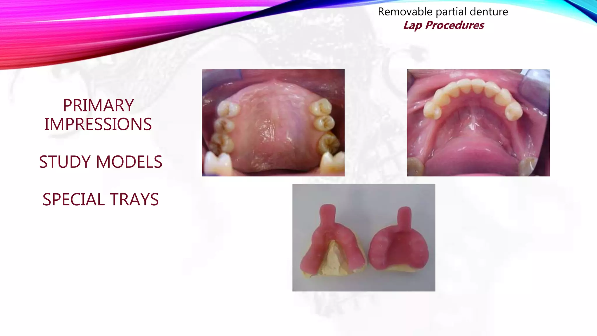 Lab steps of partial denture framework construction | PPTX