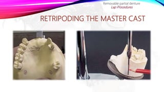 Lab steps of partial denture framework construction | PPTX