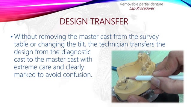 Lab steps of partial denture framework construction | PPTX