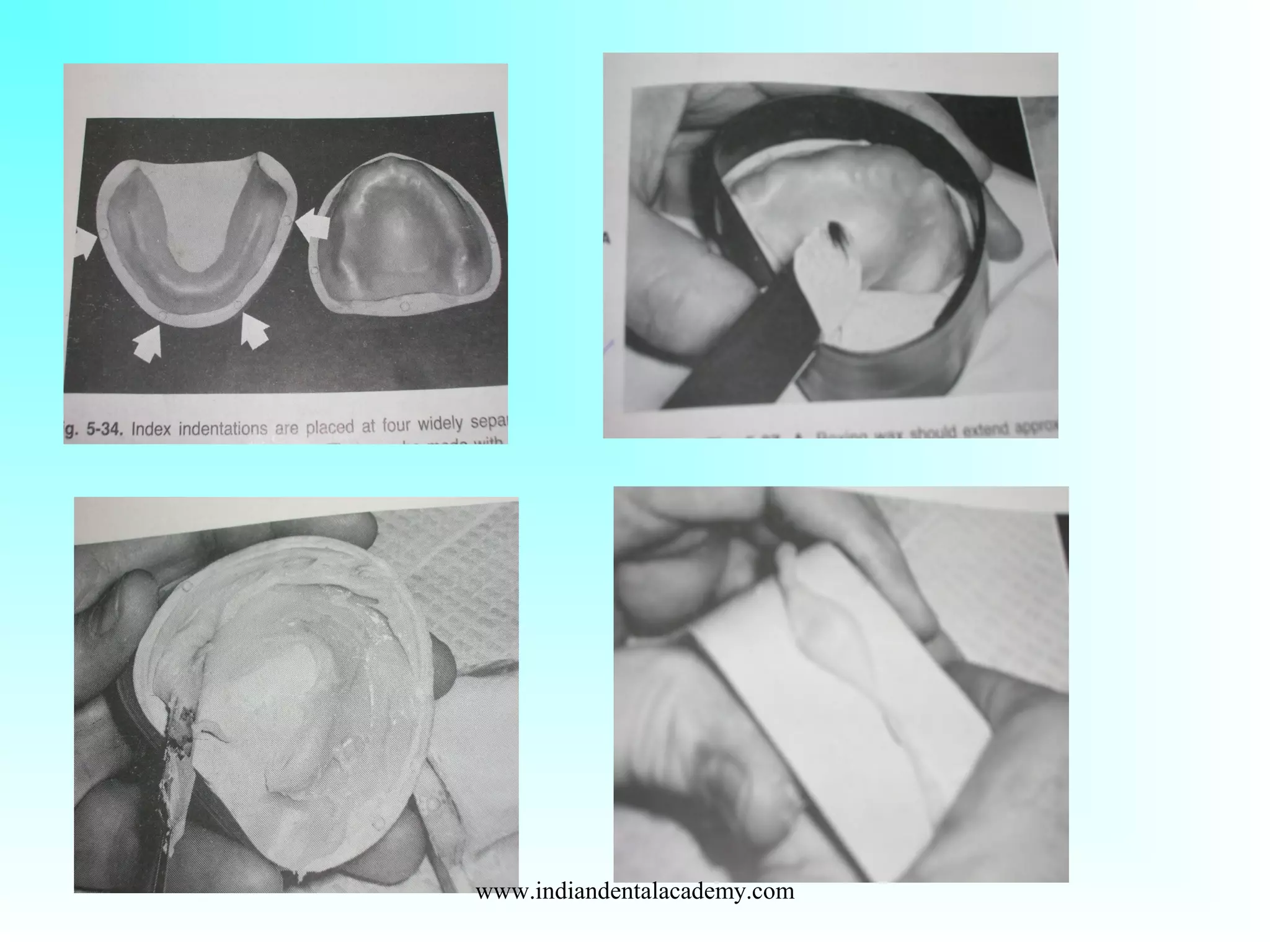 Lab procedures in complete denture prosthodontics/prosthodontic courses ...