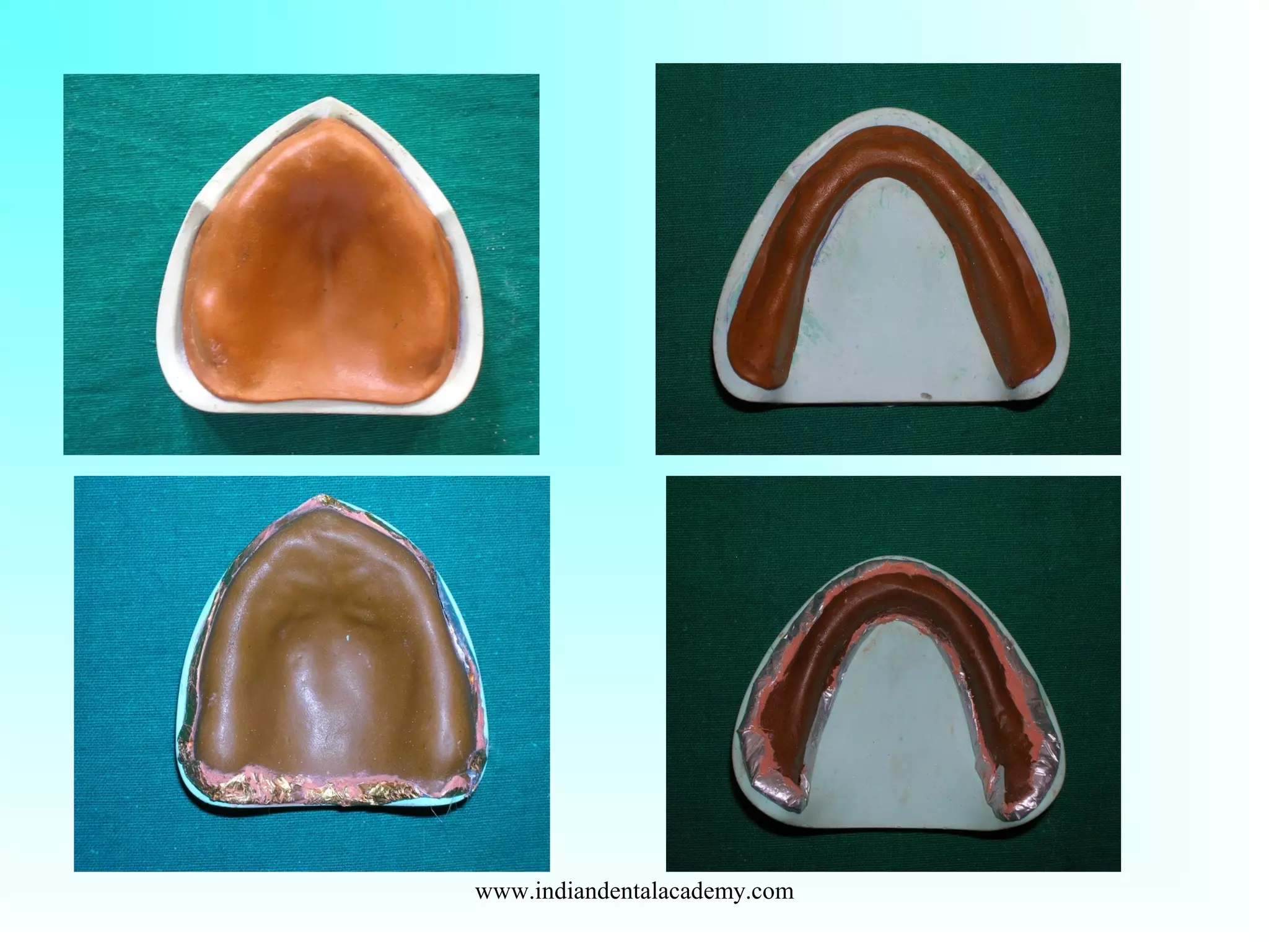 Lab procedures in complete denture prosthodontics/prosthodontic courses ...