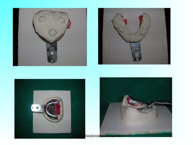 Lab procedures in complete denture prosthodontics/prosthodontic courses ...