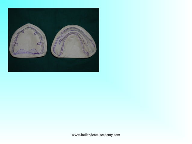 Lab procedures in complete denture prosthodontics/prosthodontic courses ...