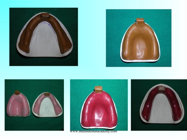 Lab procedures in complete denture prosthodontics/prosthodontic courses ...