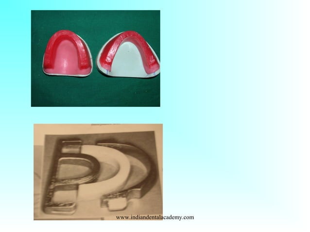 Lab procedures in complete denture prosthodontics/prosthodontic courses ...