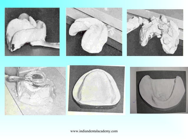 Lab procedures in complete denture prosthodontics/prosthodontic courses ...