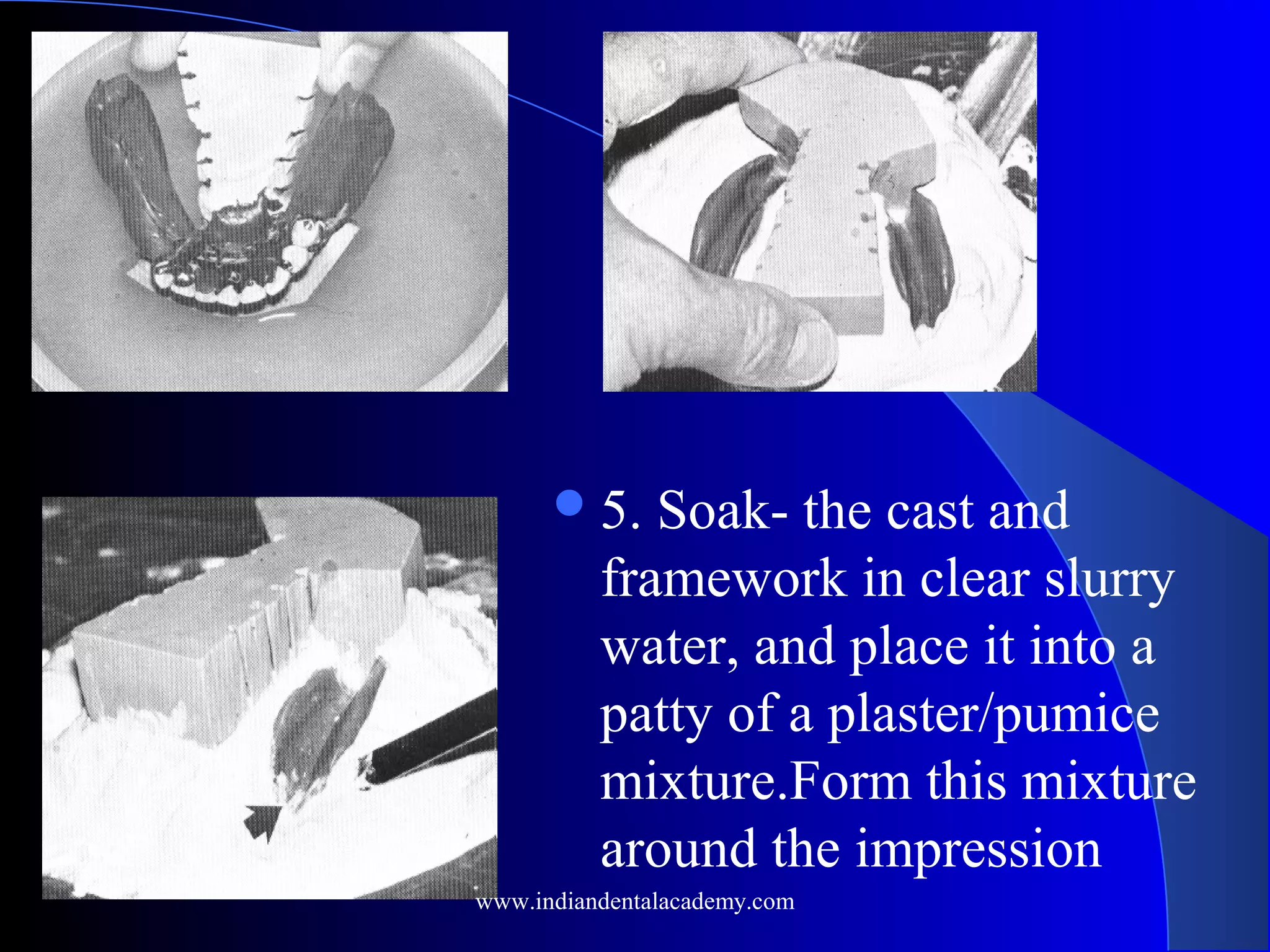 Lab procedures in conventional cast partial dentures / dental lab ...