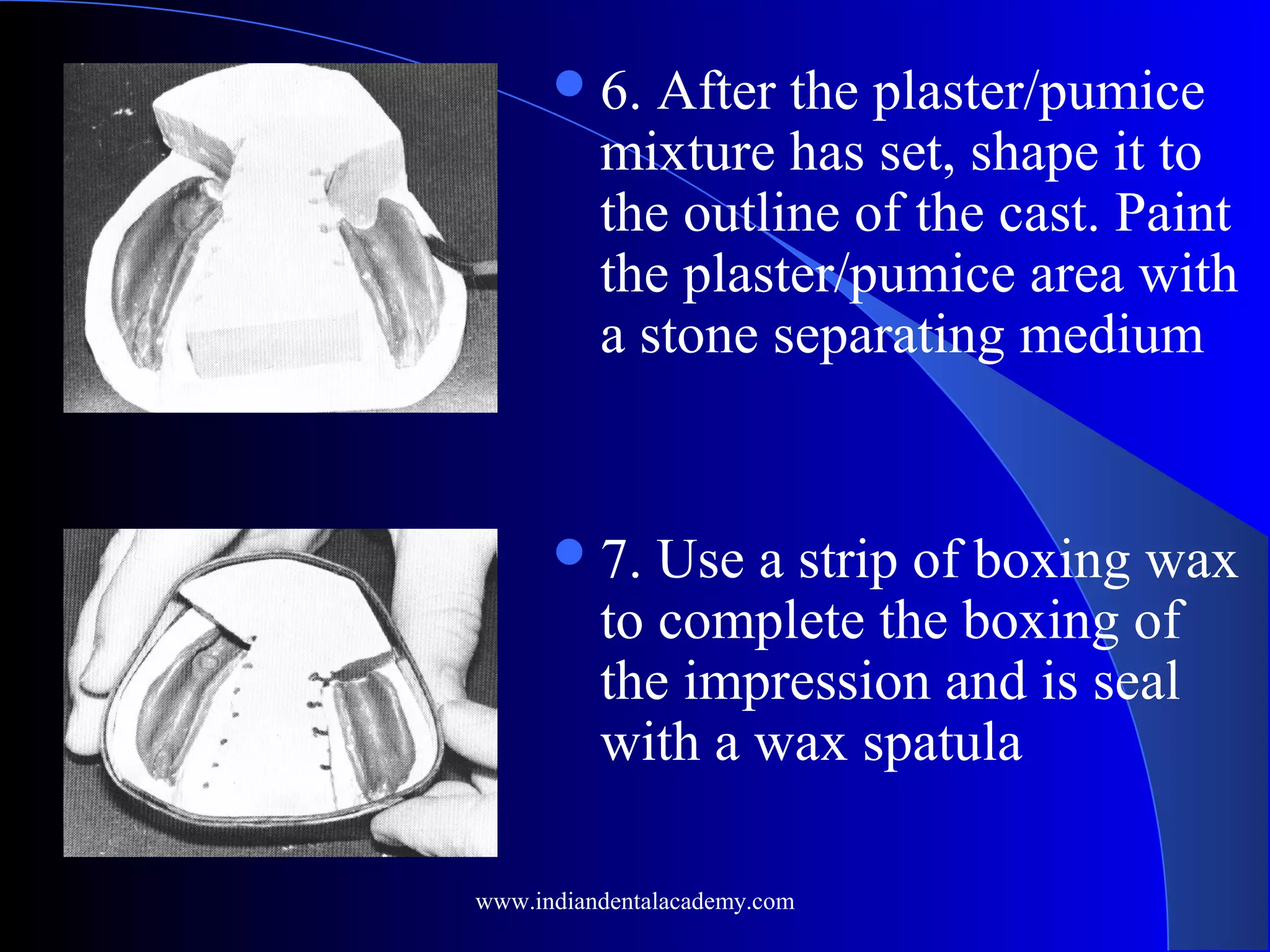 Lab procedures in conventional cast partial dentures / dental lab ...