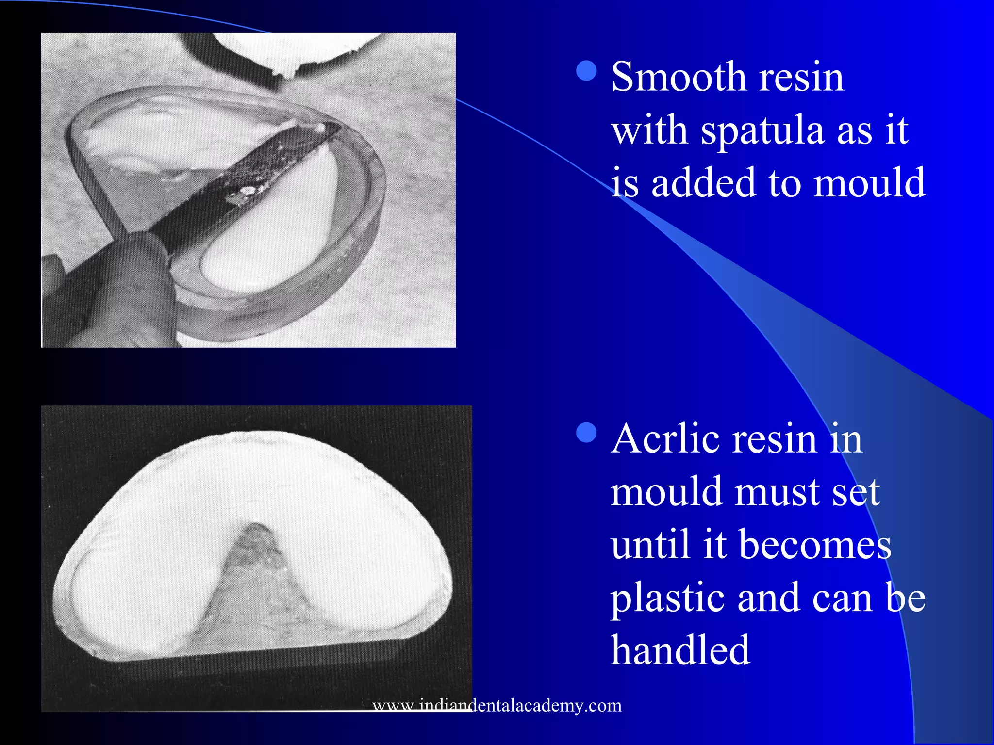 Lab procedures in cast partial dentures / dental lab courses | PPT