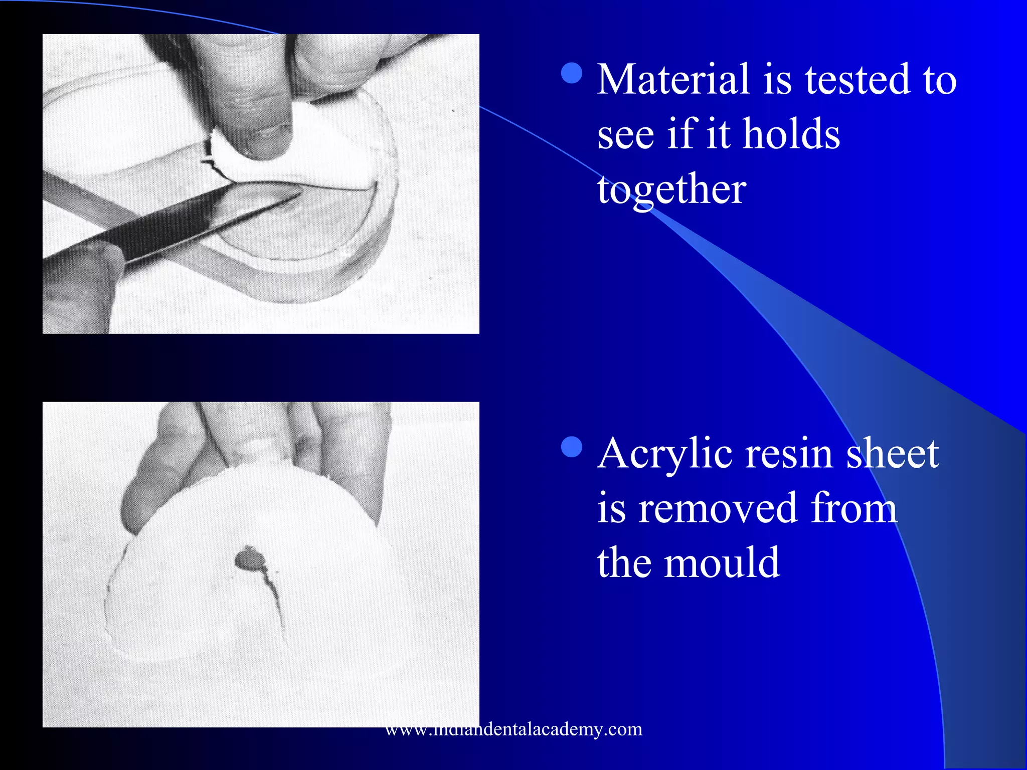 Lab procedures in cast partial dentures / dental lab courses | PPT