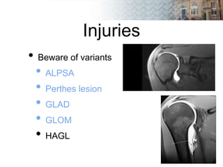 Labral injuries and traumatic instability | PPT
