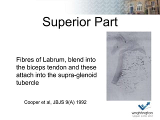 Labral injuries and traumatic instability | PPT