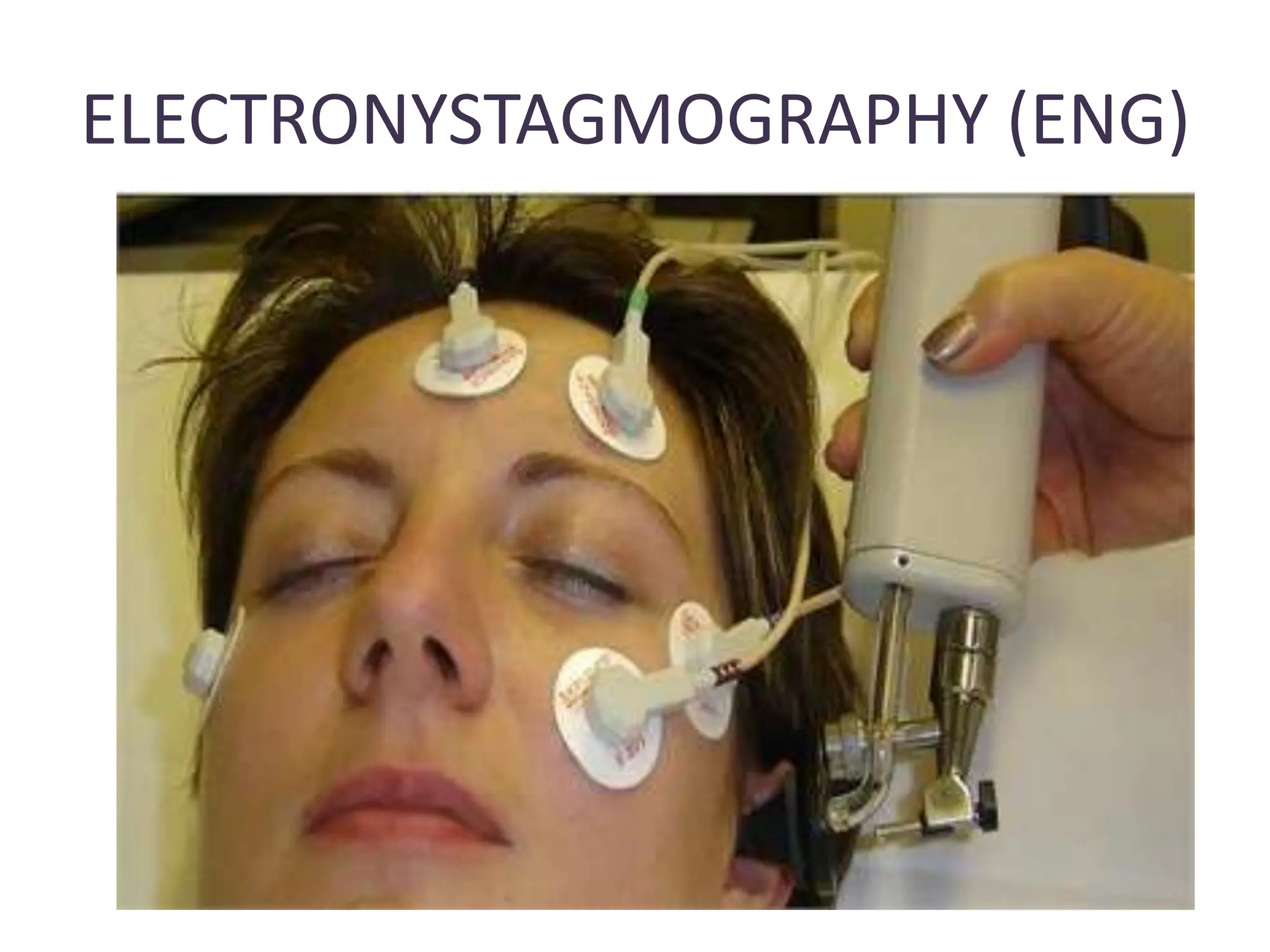 LABRINTITIS. disorder of inner ear affect hearing | PPTX