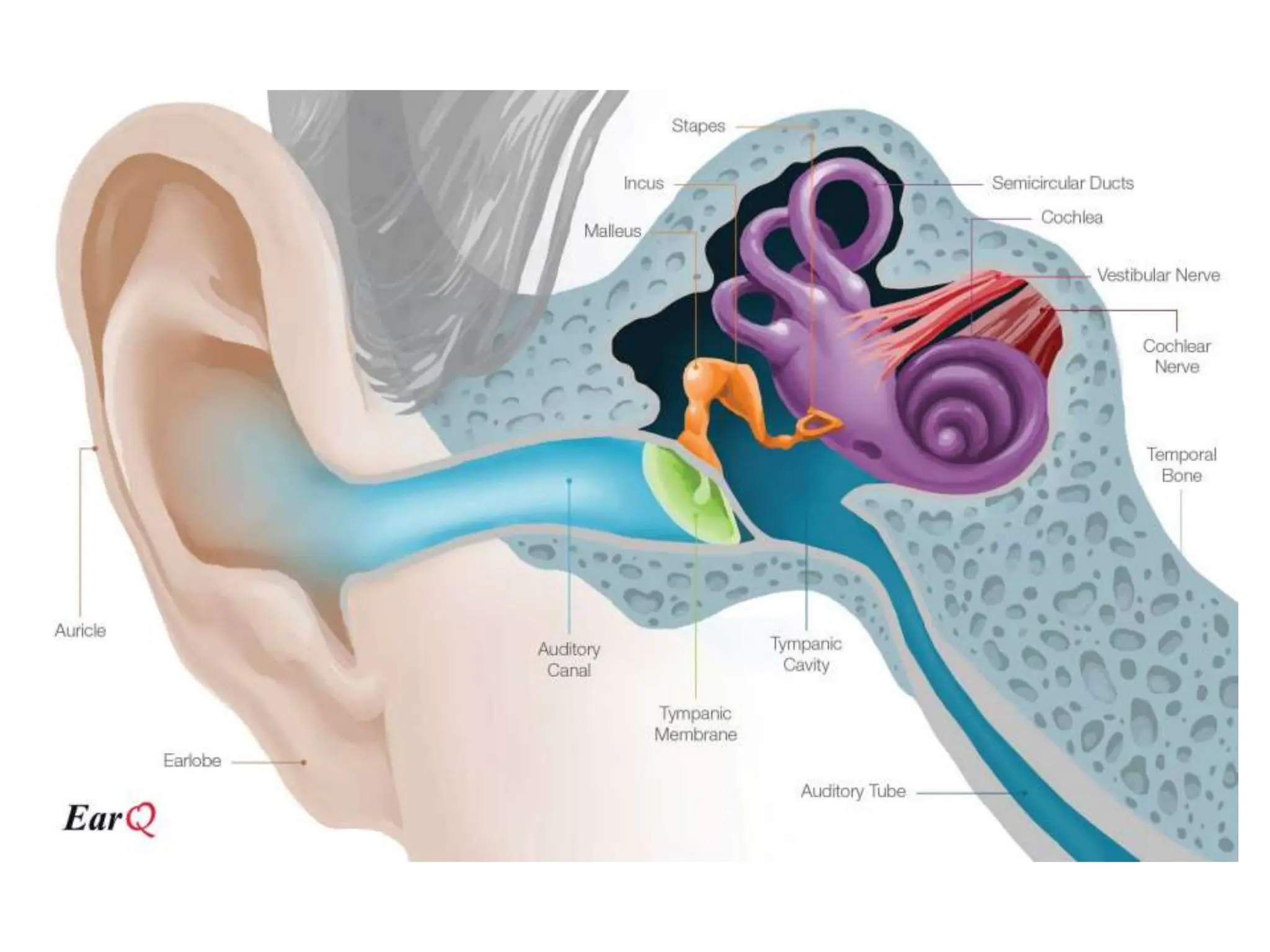 LABRINTITIS. disorder of inner ear affect hearing | PPTX | Brain and ...