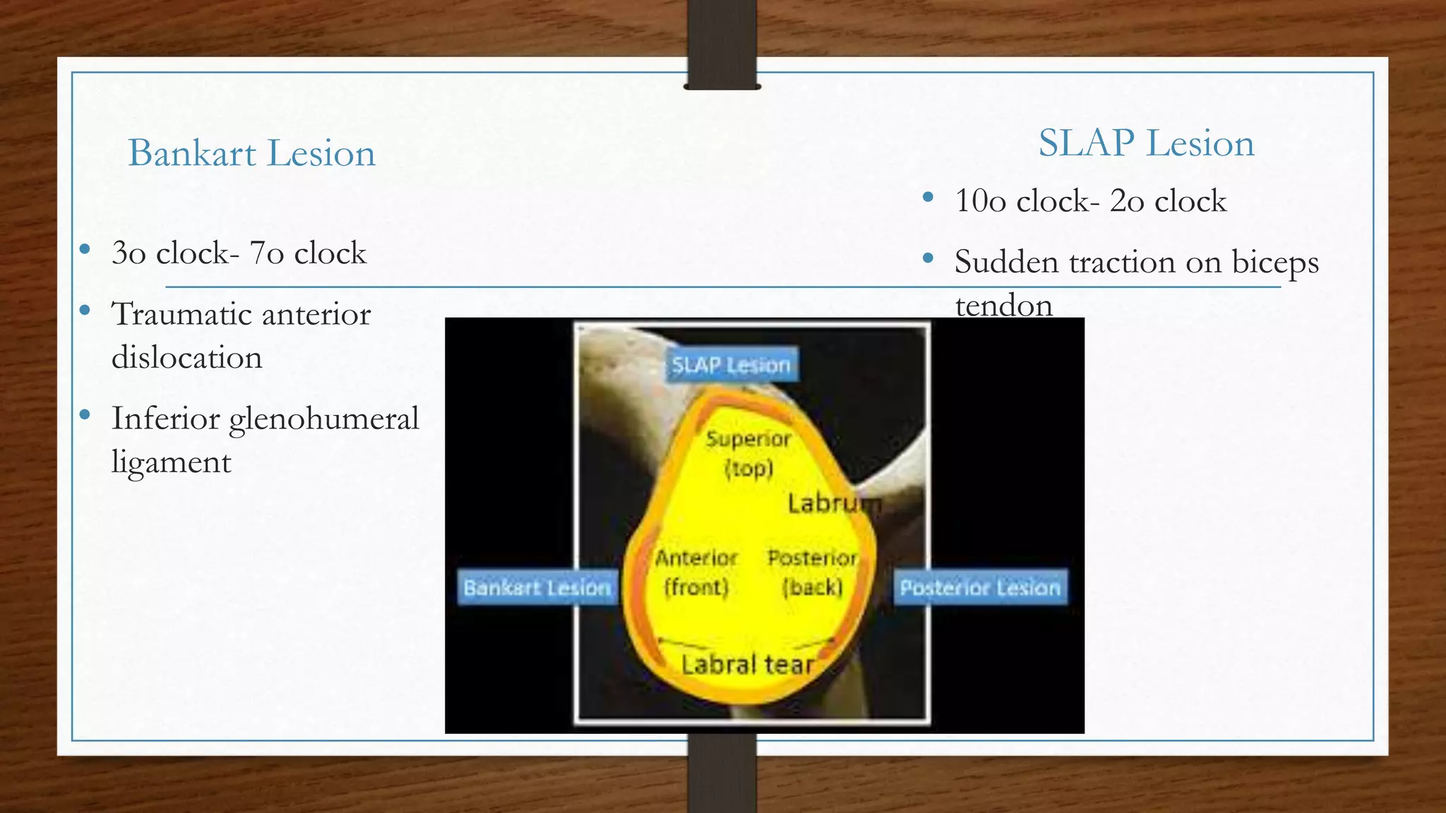 special test for labrum tear .pptx