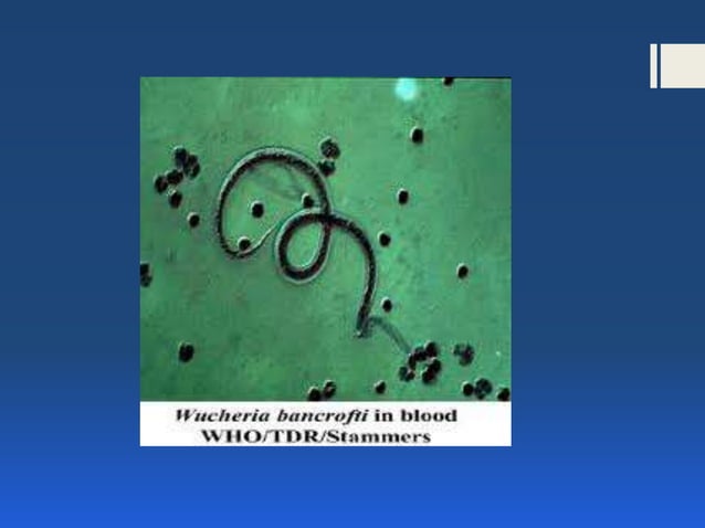 Wuchereria bancrofti - Filariasis | PPTX | Infectious Diseases ...
