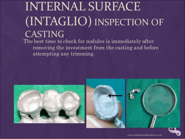 Dental Lab steps from mould preparation to finish/ dental education i…