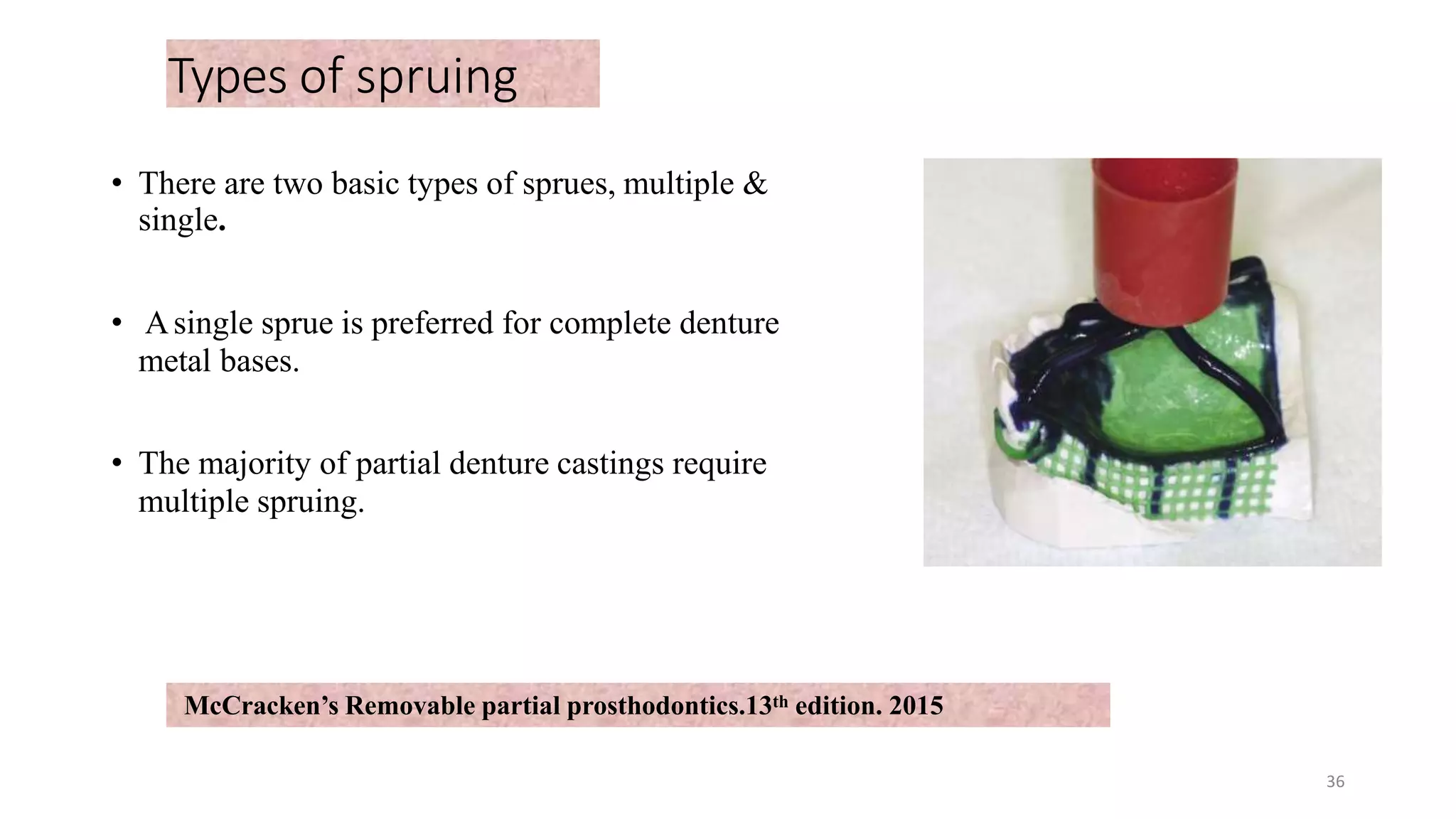 Lab steps in rpd | PPTX | Oral care | Personal Care