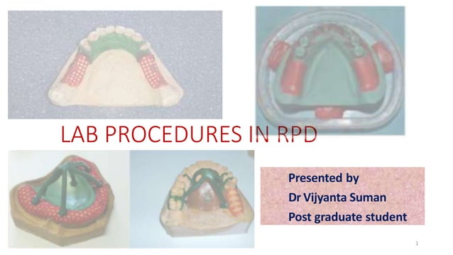 Lab steps in rpd | PPTX | Oral care | Personal Care