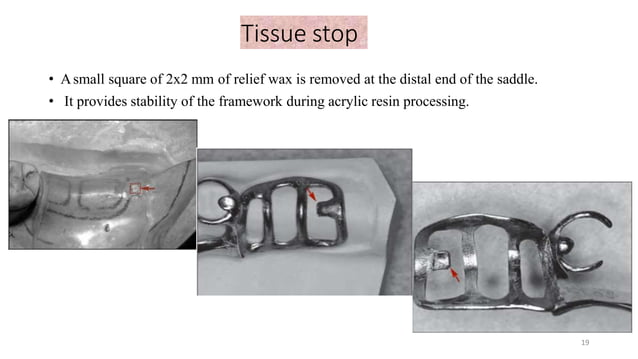 Lab steps in rpd | PPTX | Oral care | Personal Care