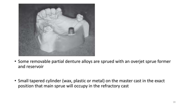 Lab steps in rpd | PPTX | Oral care | Personal Care
