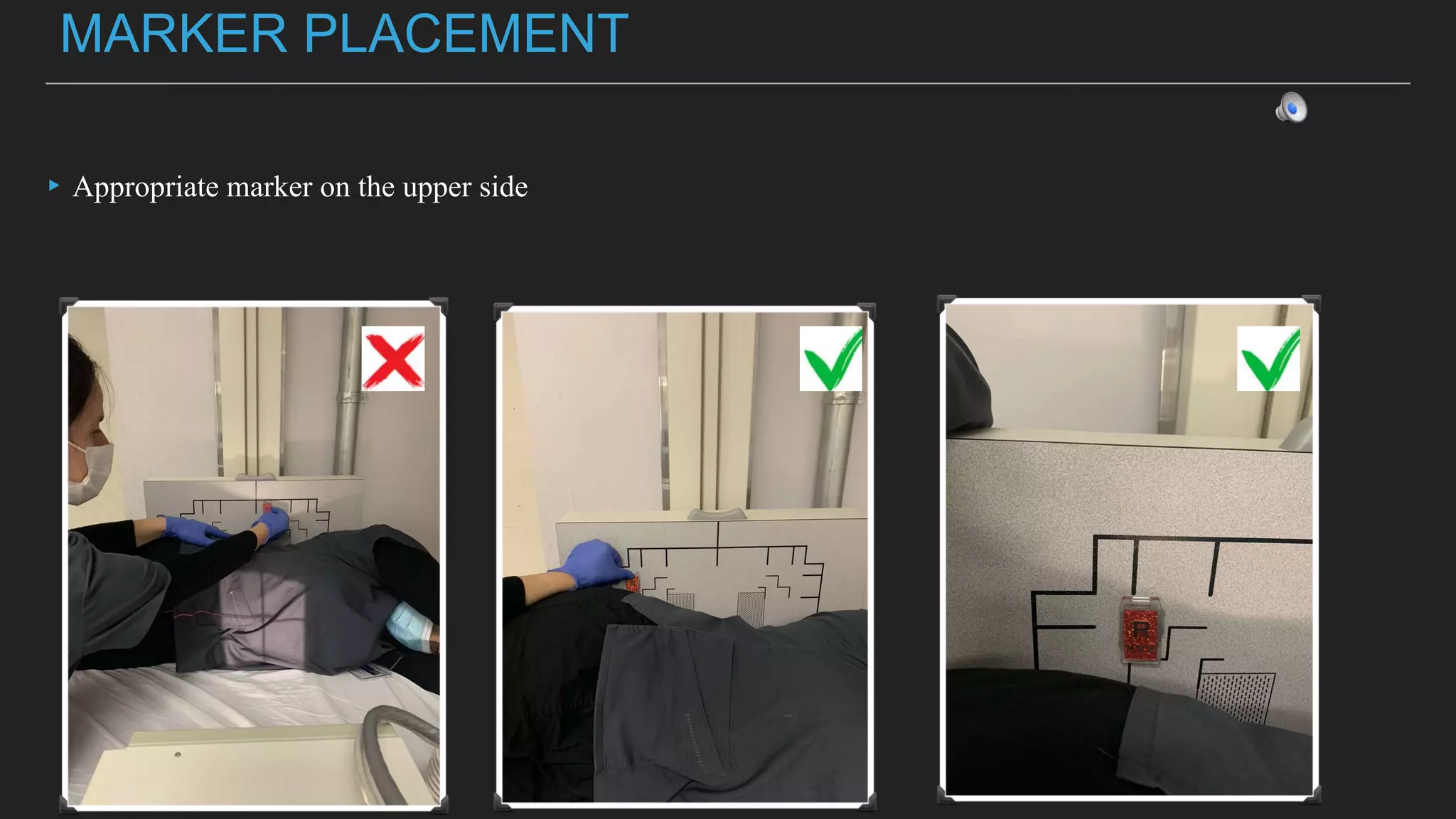 Radiology. Lab test.Chest / Abdomen Decubitus | PPTX