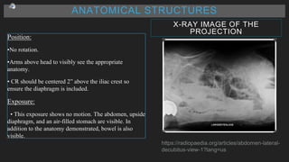 Radiology. Lab test.Chest / Abdomen Decubitus | PPTX