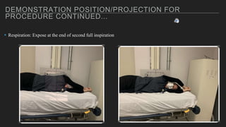 Radiology. Lab test.Chest / Abdomen Decubitus | PPT