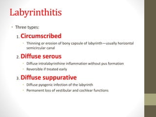 Labyrinthitis and its management | PPT