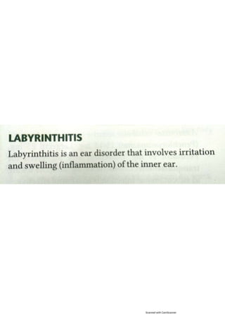 Labyrinthitis ppt | PDF