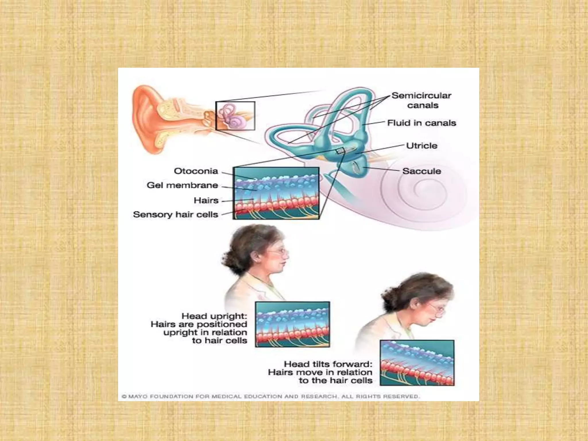 Labyrinthitis | PPTX | Ear, Nose and Throat Conditions | Diseases and ...