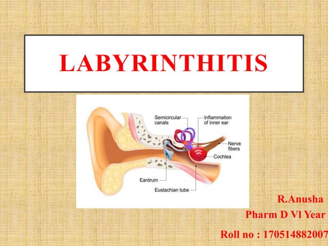 Labyrinthitis | PPT