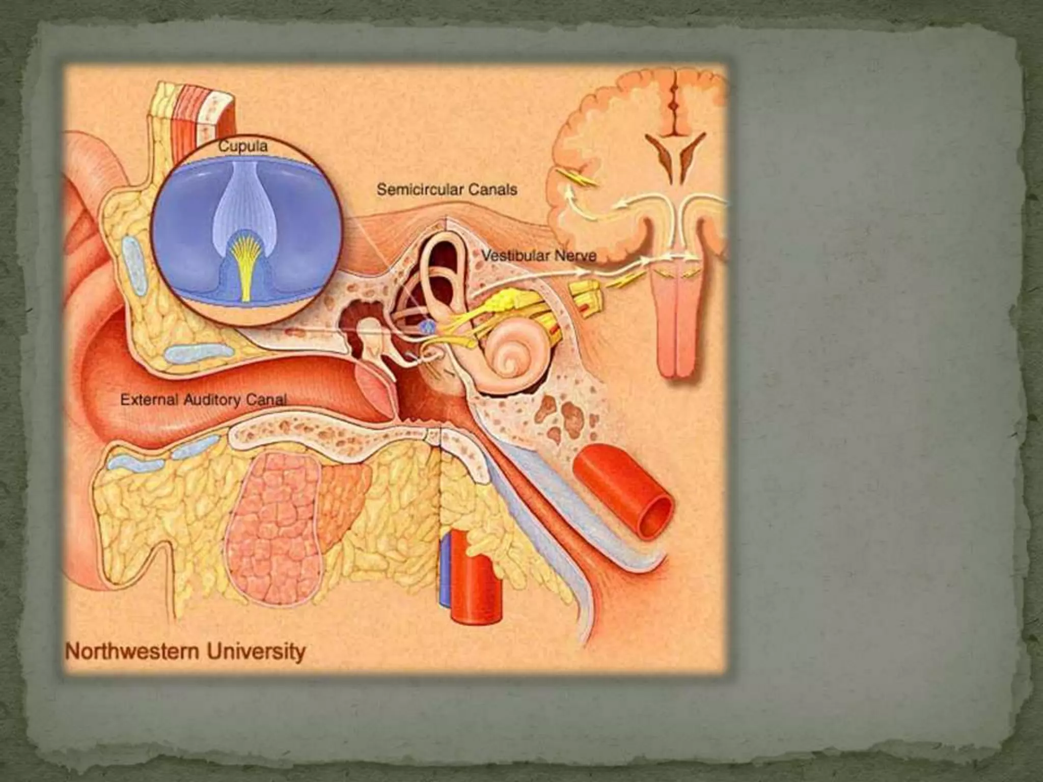Labyrinthitis the inner ear infection | PPTX