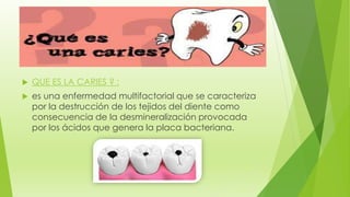 LA CARIES DENTAL | PPTX