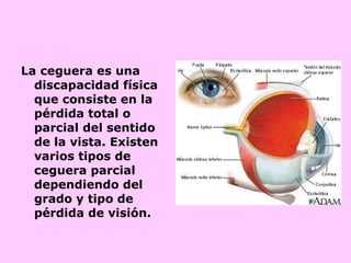 La ceguera | PPT