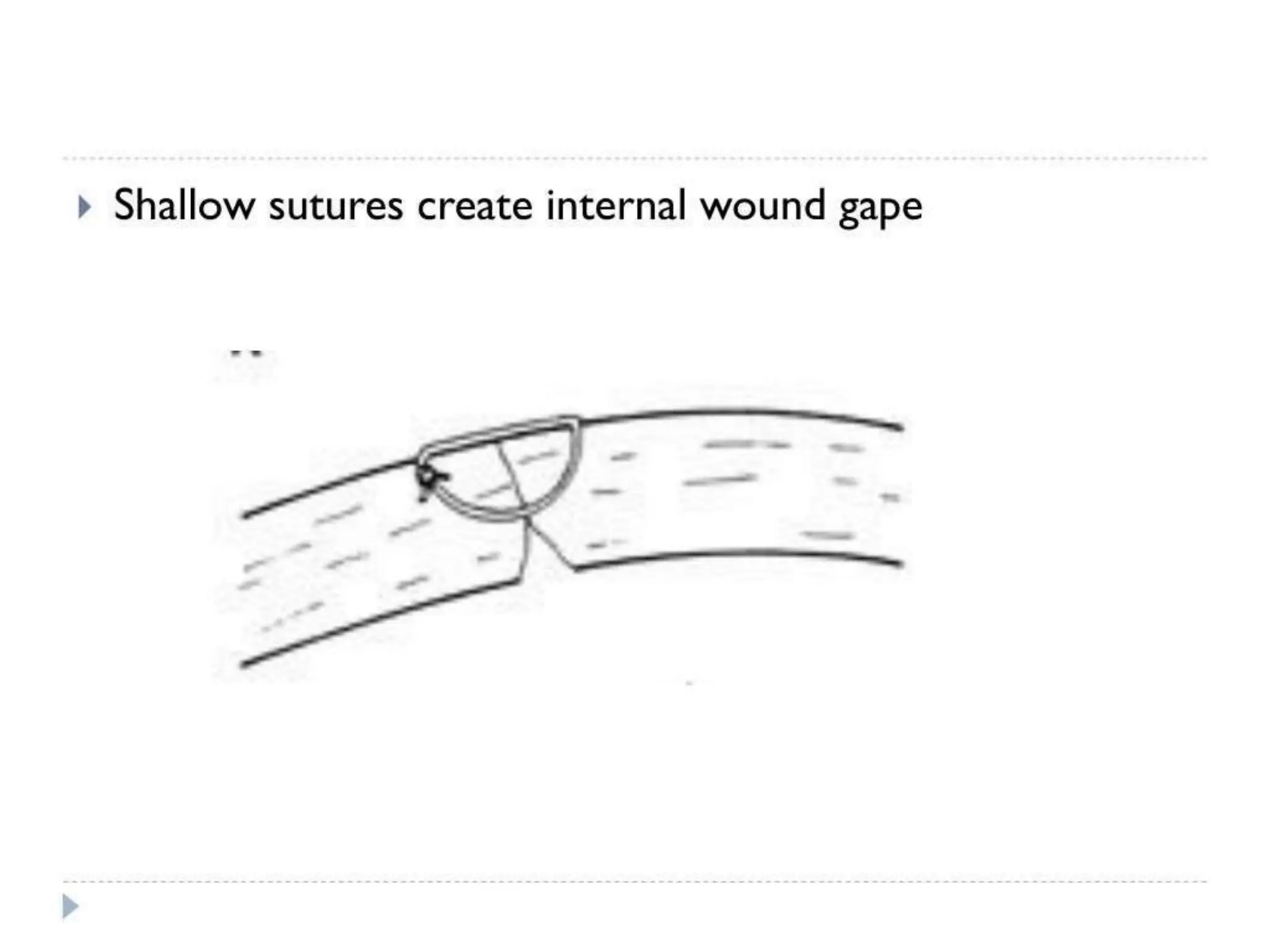 corneal l injury and laceration in eye.pptx