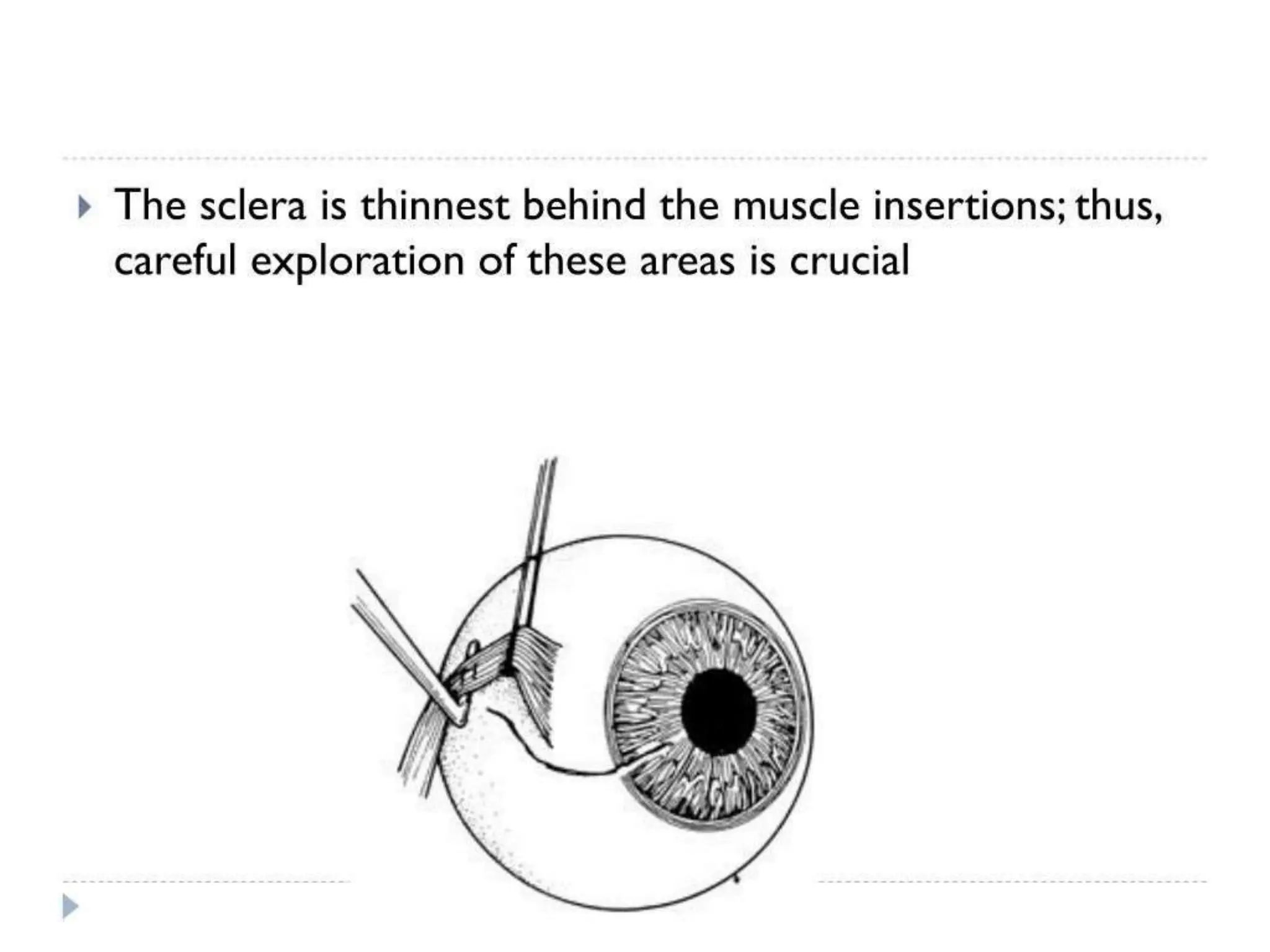 corneal l injury and laceration in eye.pptx