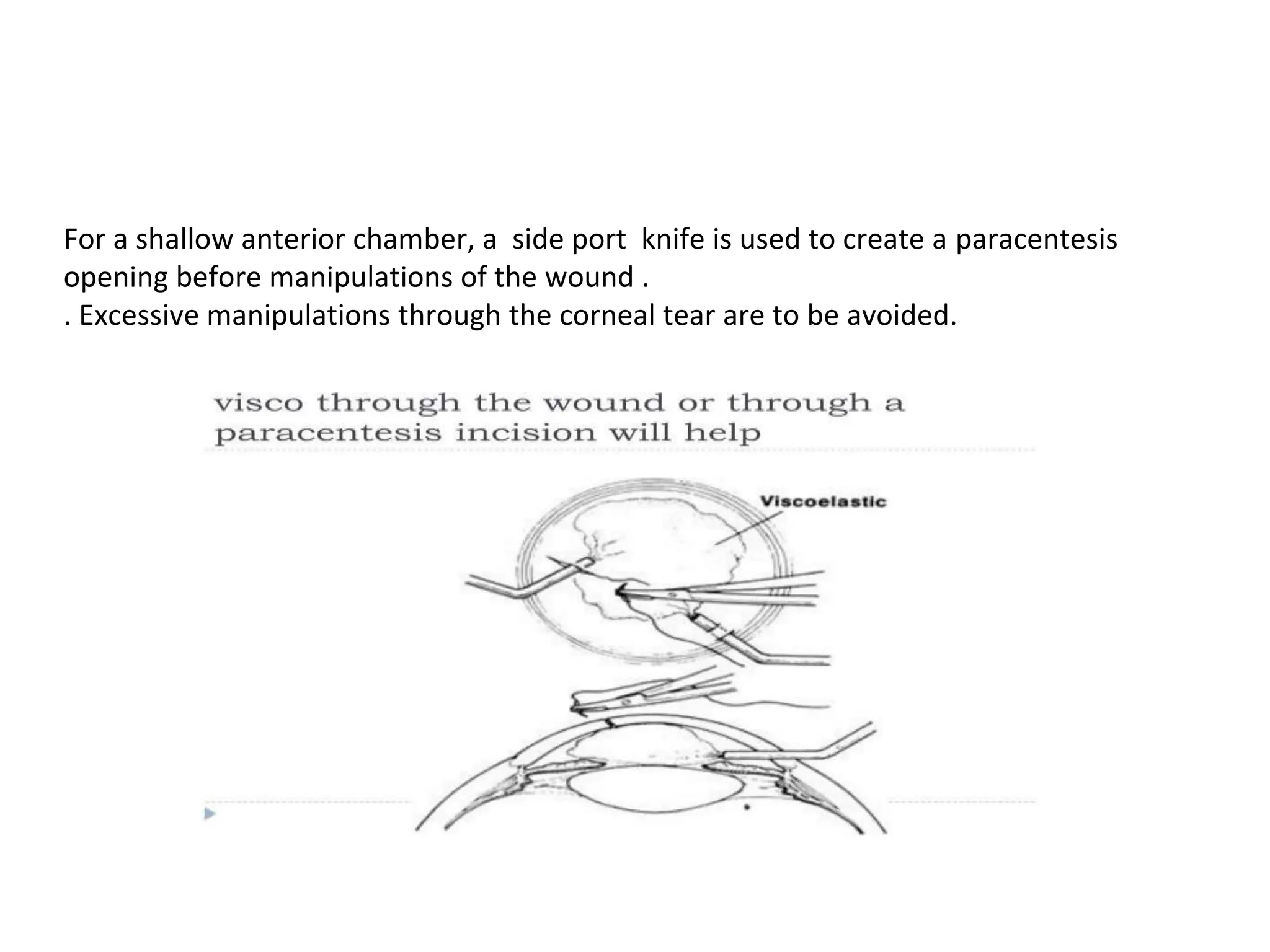 corneal l injury and laceration in eye.pptx