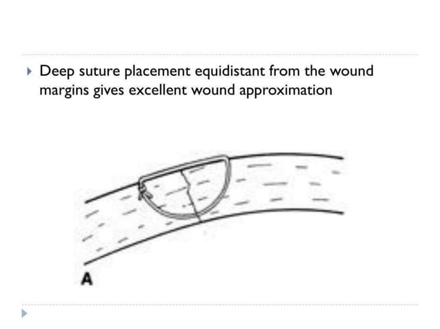 corneal l injury and laceration in eye.pptx