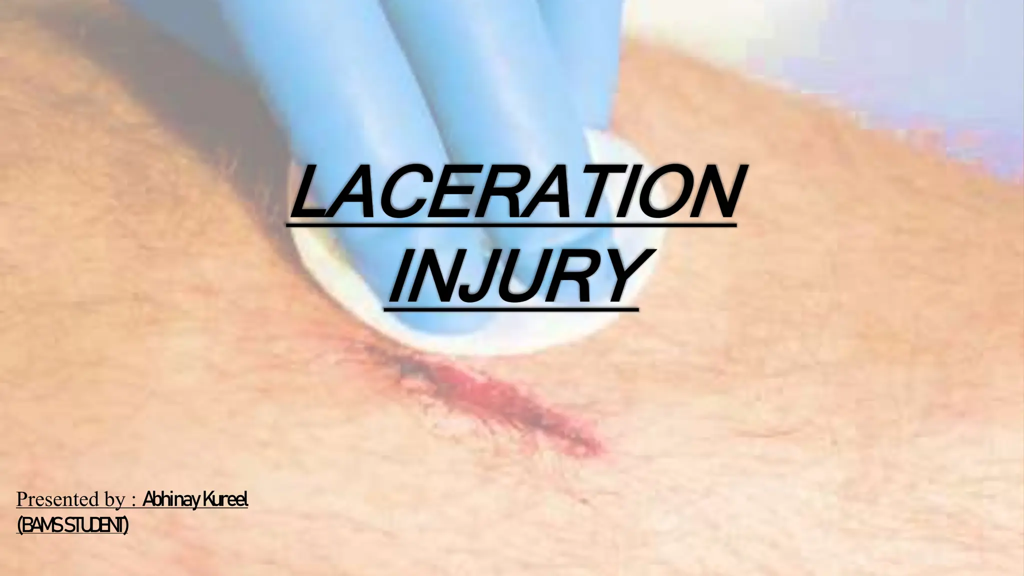 LACERATION INJURY | PPT | PPTX