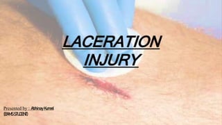 LACERATION INJURY | PPT | PPTX