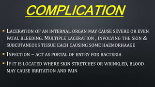 LACERATION INJURY | PPT | PPTX