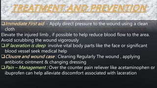 LACERATION INJURY | PPT | PPTX