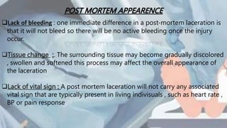 LACERATION INJURY | PPT | PPTX