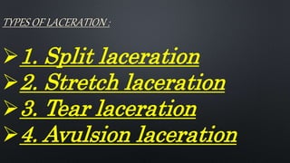 LACERATION INJURY | PPT | PPTX