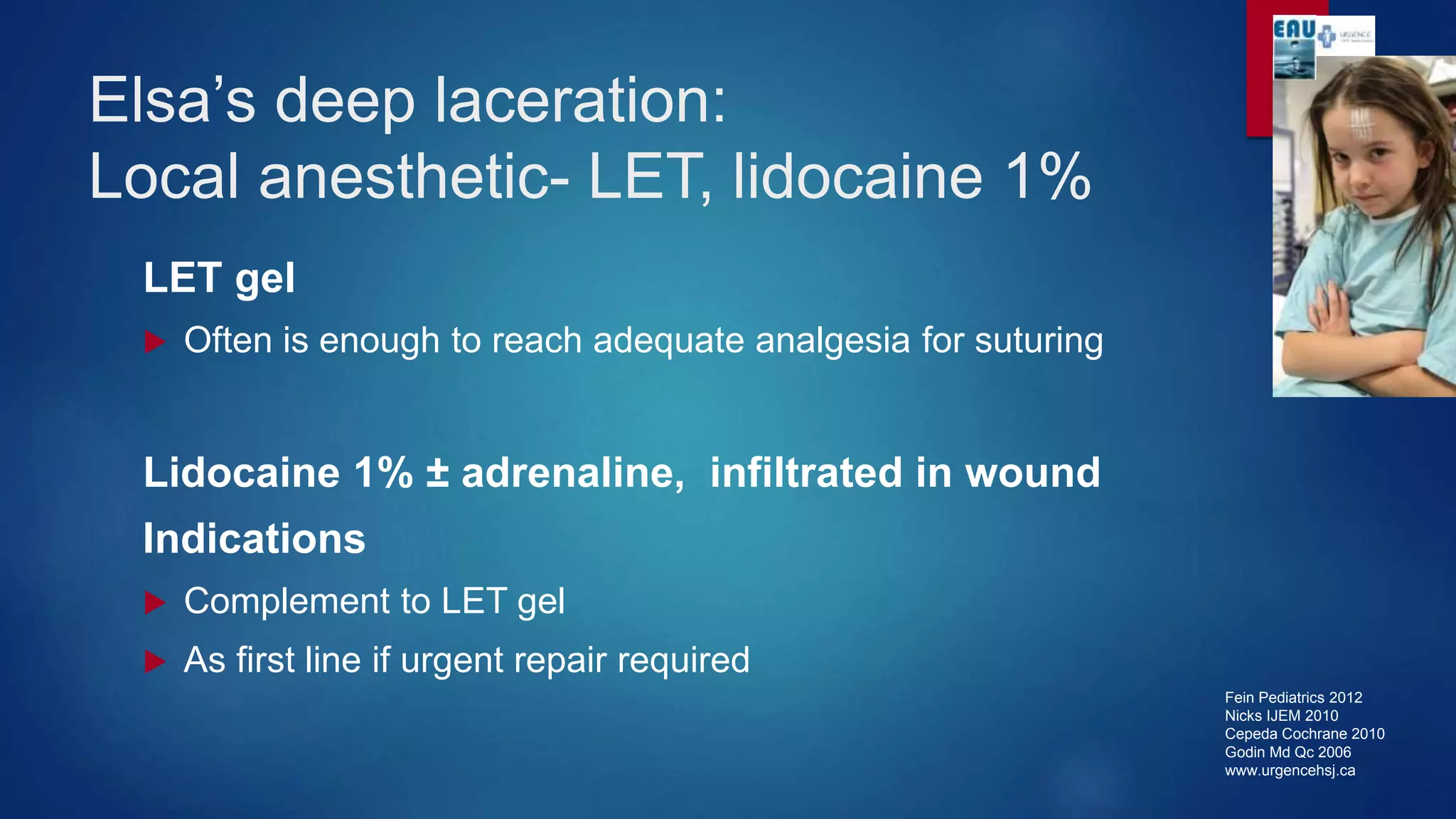 Lacerations | PPTX