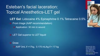 Lacerations | PPTX