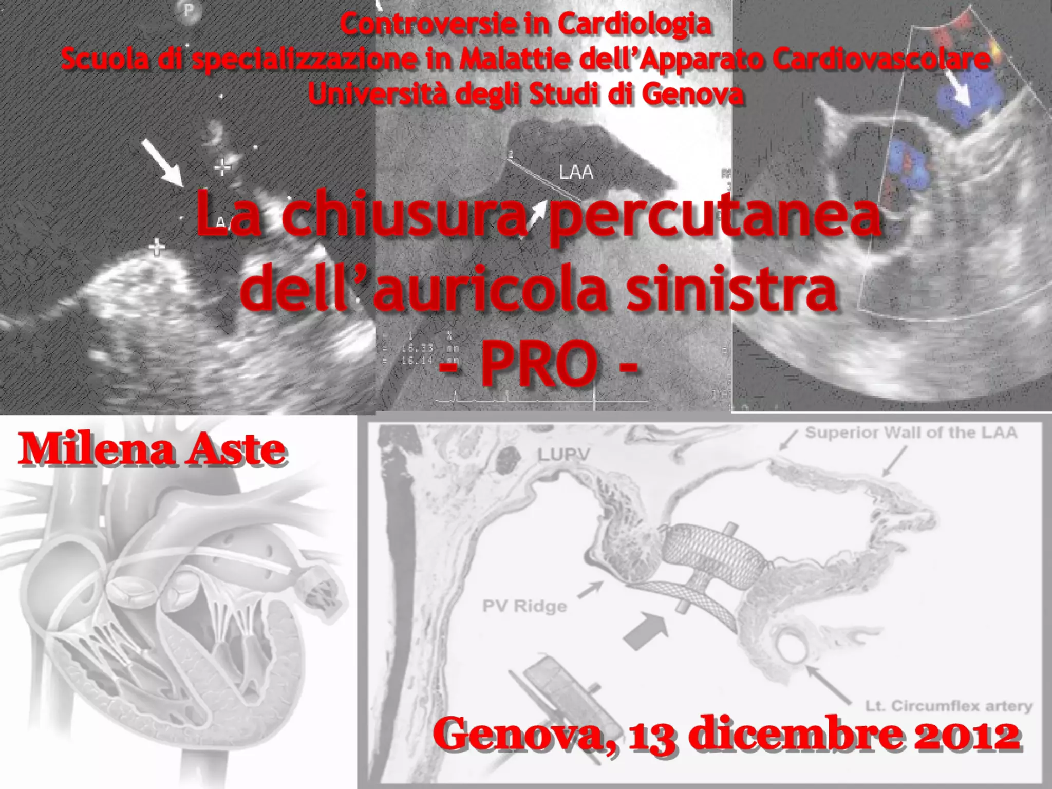 La chiusura percutanea dell'auricola pro definitivo | PPT